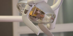 Zahnabszess Ursache | Was hilft wirklich? | DER ZAHN PROFI 2020